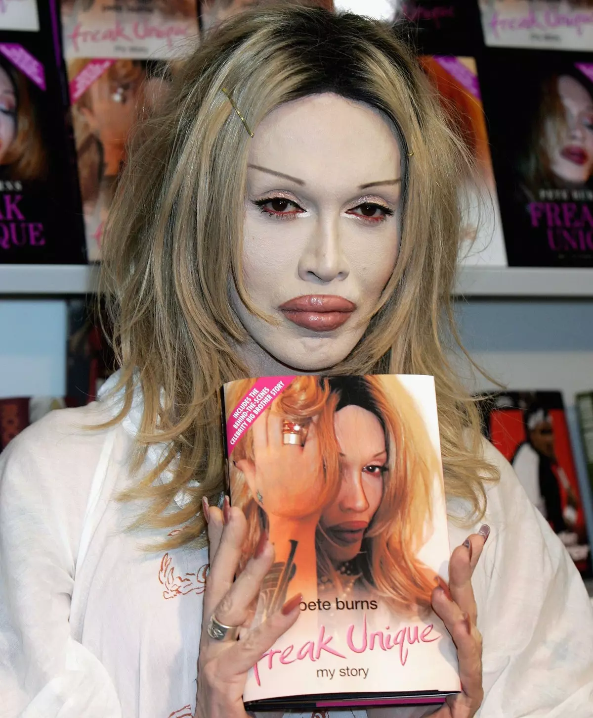 Pete Burns during the presentation of his autobiography Freak Unique. This was in 2005. Seen now his face was a...