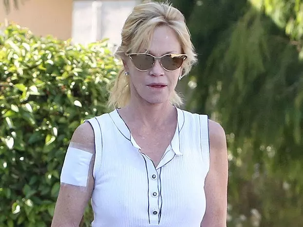 Melanie Griffith goes to a beauty center to remove the tattoo on her arm.