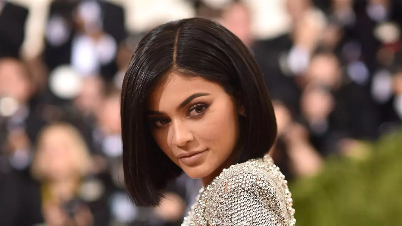 Đây là cách Kylie Jenner có vết sẹo khổng lồ trên chân mà cô ấy tự hào khoe trên trang bìa mới nhất của mình