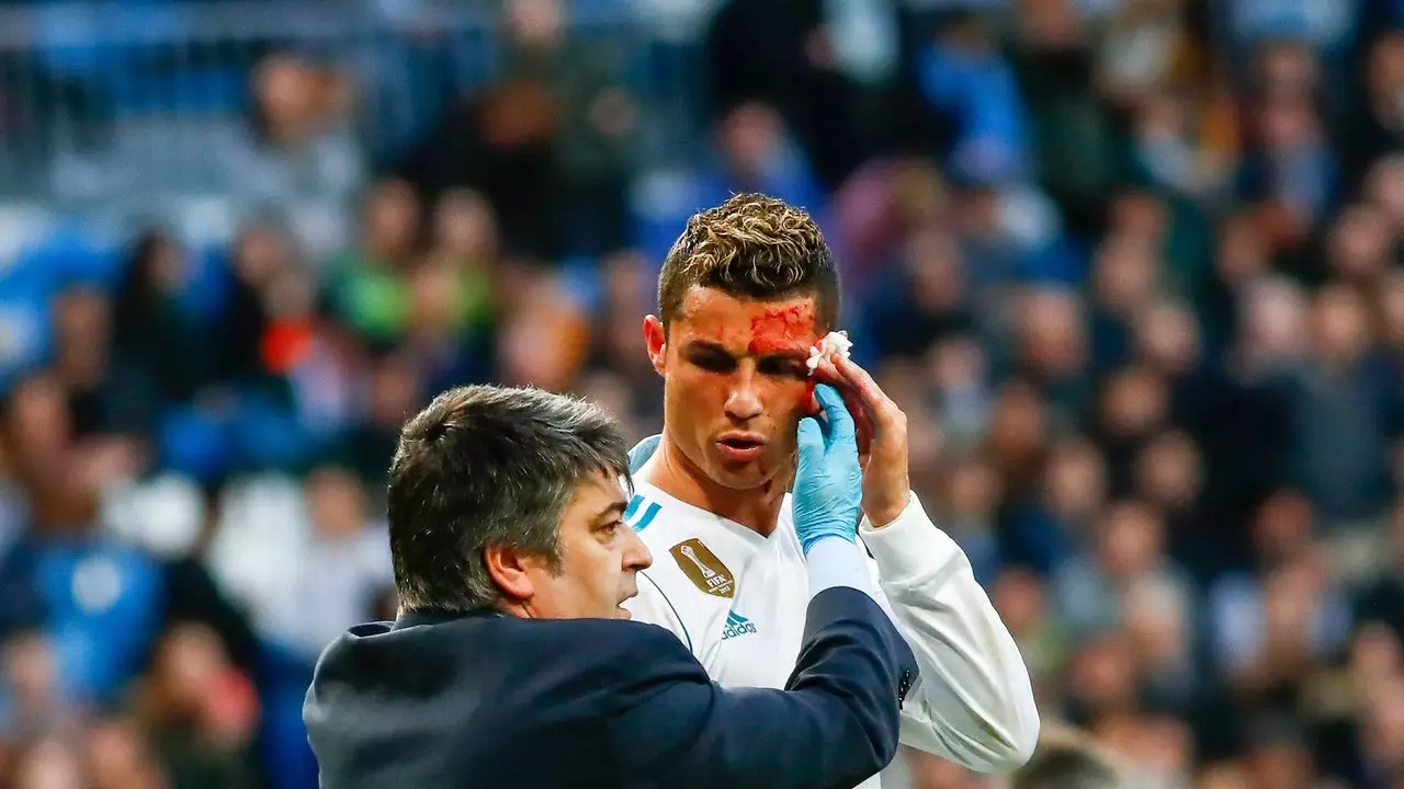 Cristiano Ronaldo używa telefonu komórkowego jako lustra po kontuzji