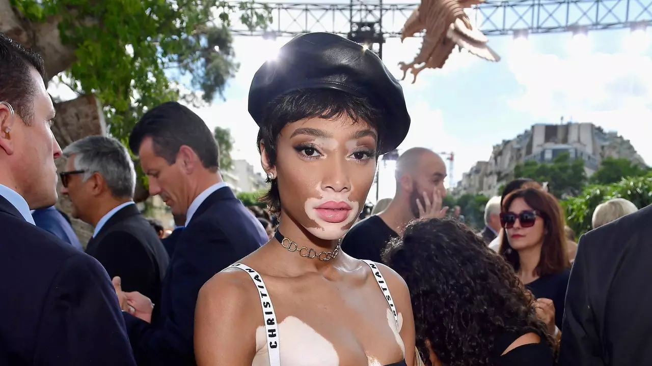 Att anklaga Winnie Harlow för "fat shaming" är meningslöst